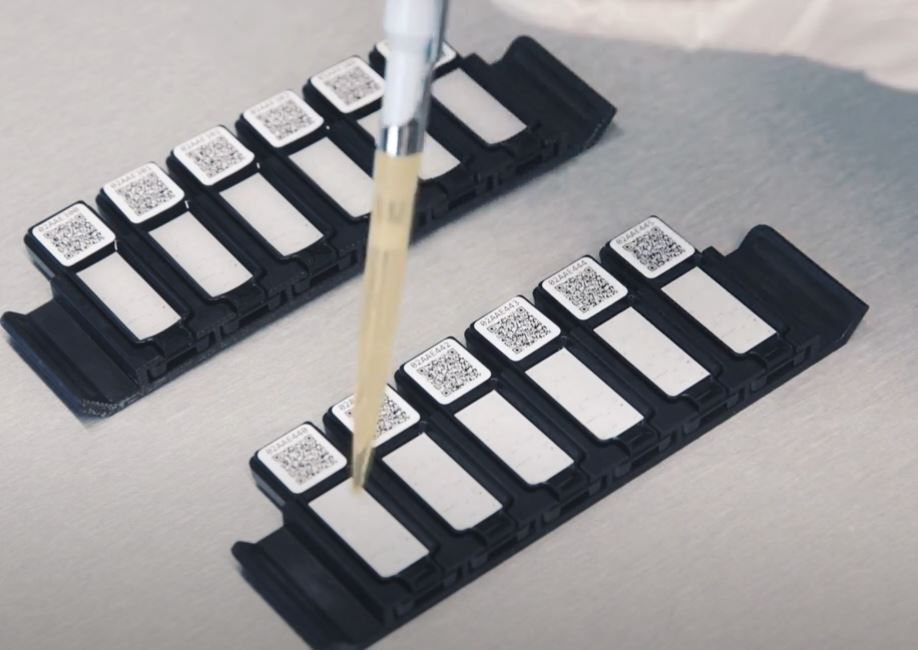 ALEX test Allergy (ALEX2) - StArtBio Διαγνωστικό Κέντρο