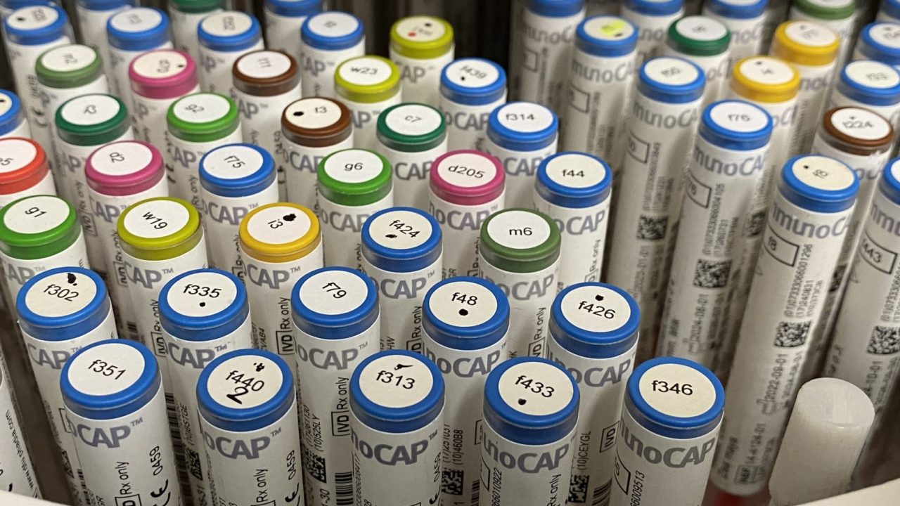 Specific IgE ImmunoCAP Allergy Test - StArtBio Διαγνωστικό Κέντρο